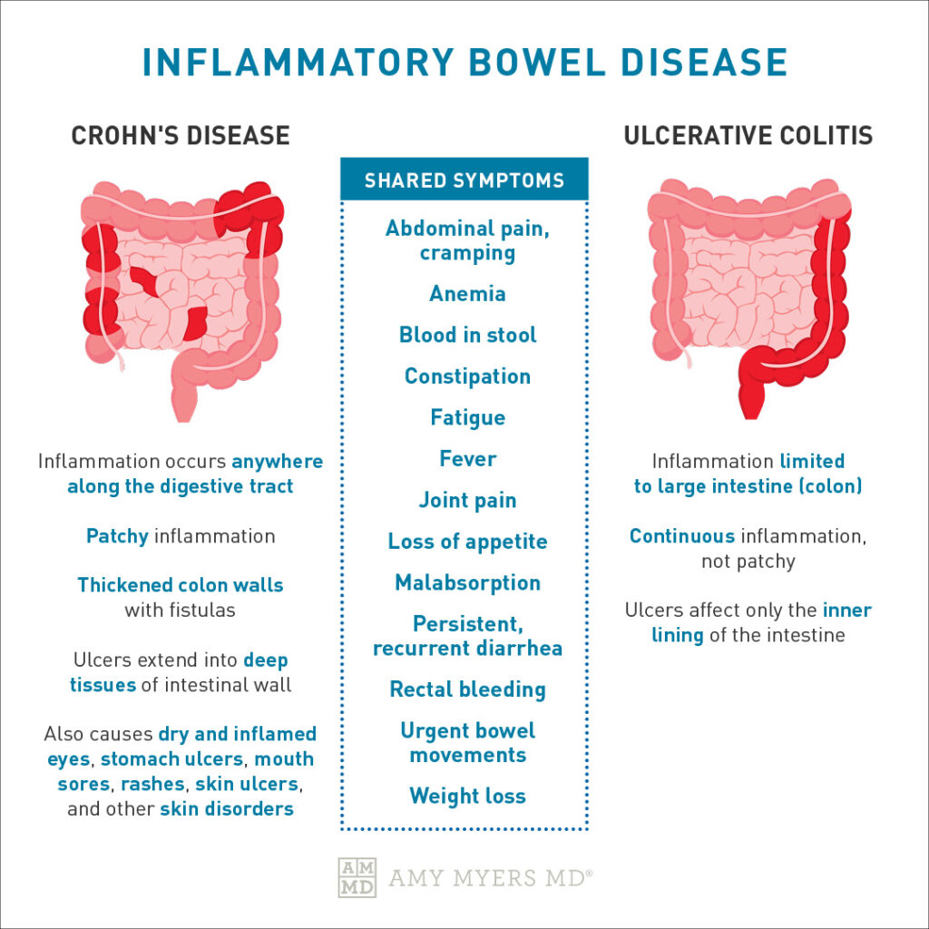 The Myers Way® Approach to Inflammatory Bowel Disease – Amy Myers MD