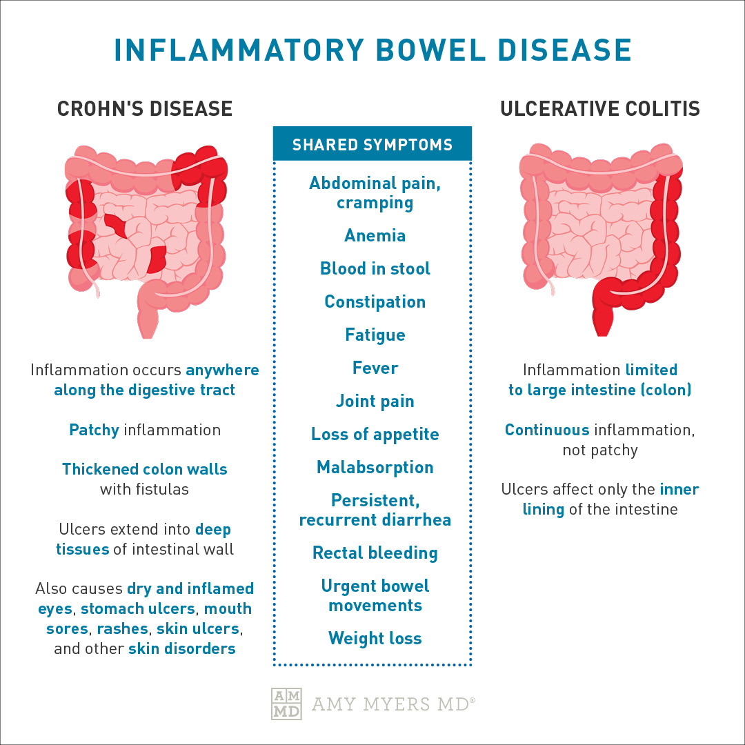 The Myers Way® Approach to Inflammatory Bowel Disease – Amy Myers MD