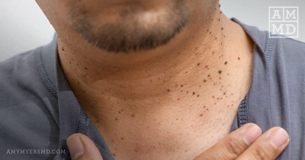 What Your Skin Says About Your Health | Amy Myers MD